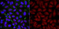 Anti-TERT Antibody | ABE2075